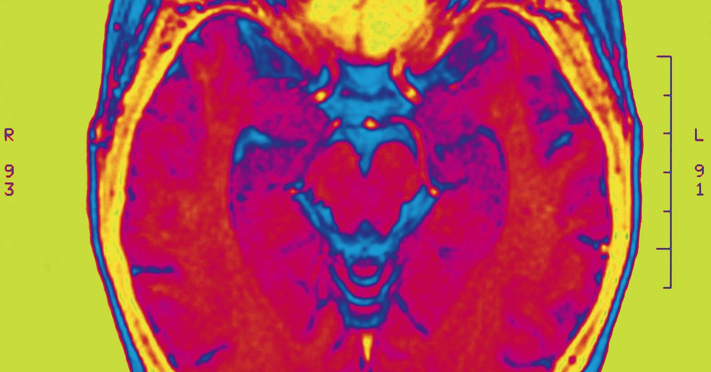 Changes In Teenage Brain Give Clues To Mental Health Issues WIRED UK changes-in-teenage-brain-give-clues-to-mental-health-issues-wired-uk